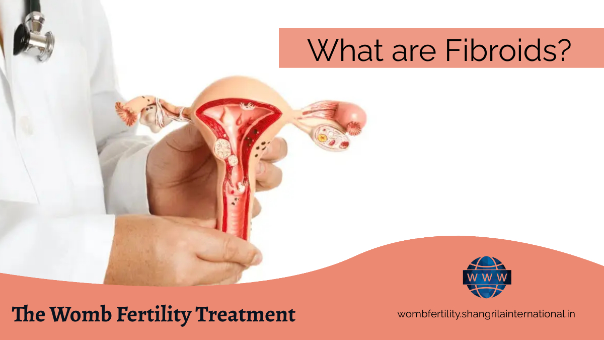 What are Fibroids? – The Womb Fertility Treatment