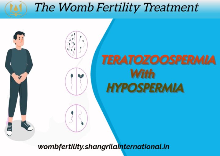 Teratozoospermia With Hypospermia – The Womb Fertility Treatment